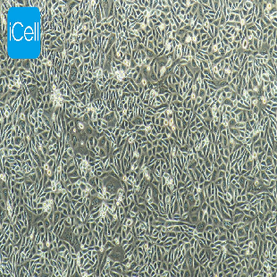 OV-90 人卵巢癌细胞-原代细胞-STR细胞-细胞培养基-镜像绮点生物