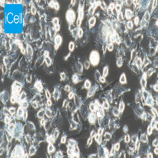 NOZ 人胆囊癌细胞（暂不提供）-原代细胞-STR细胞-细胞培养基-镜像绮点生物