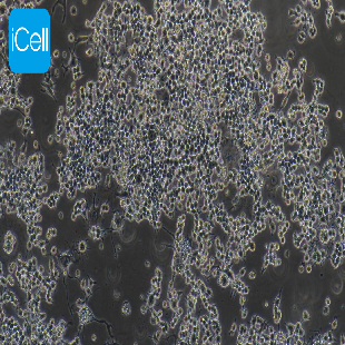 neuro-2a（N2A）小鼠脑神经瘤细胞-原代细胞-STR细胞-细胞培养基-镜像绮点生物