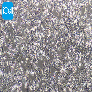 NCI-H1703 人肺鳞癌细胞-Human Lung Squamous cell Carcinoma Cells | EIAab