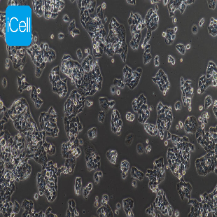 NCI-H520人肺鳞癌细胞-原代细胞-STR细胞-细胞培养基-镜像绮点生物