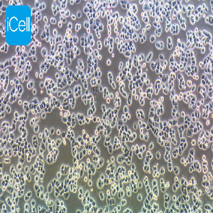 MDA-MB-468 人乳腺癌细胞-原代细胞-STR细胞-细胞培养基-赛百慷生物