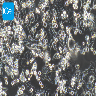 MB-49 小鼠膀胱癌细胞-原代细胞-STR细胞-细胞培养基-镜像绮点生物