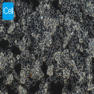 LS174T 人结直肠腺癌细胞-原代细胞-STR细胞-细胞培养基-镜像绮点生物