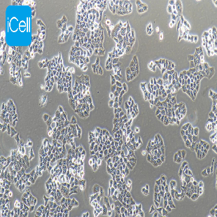 KB 人口腔表皮癌细胞-原代细胞-STR细胞-细胞培养基-镜像绮点生物