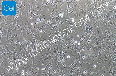 J82 人膀胱移行细胞癌-原代细胞-STR细胞-细胞培养基-镜像绮点生物