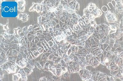 MCF-7+luc 人乳腺癌细胞+luc-原代细胞-STR细胞-细胞培养基-镜像绮点生物