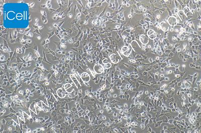 MUM2B 人侵袭性脉络膜黑色素瘤细胞-原代细胞-STR细胞-细胞培养基-镜像绮点生物