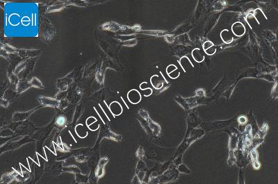 SW982 人滑膜肉瘤细胞-原代细胞-STR细胞-细胞培养基-镜像绮点生物