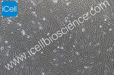 HSF(SV40转染) 人真皮成纤维细胞永生化-原代细胞-STR细胞-细胞培养基-镜像绮点生物