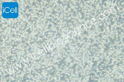 MM.1S 人多发性骨髓瘤细胞-原代细胞-STR细胞-细胞培养基-镜像绮点生物