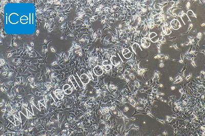 LOVO/5FU 人结直肠癌细胞氟尿嘧啶耐药株（暂不提供）-原代细胞-STR细胞-细胞培养基-镜像绮点生物