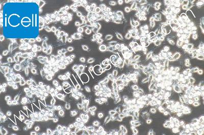 MC38+luc 小鼠结肠癌细胞稳定表达荧光素酶-原代细胞-STR细胞-细胞培养基-镜像绮点生物