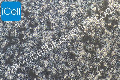 ASPC-1/GEM 人转移胰腺腺癌细胞吉西他滨耐药株-原代细胞-STR细胞-细胞培养基-镜像绮点生物