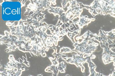 22Rv1 人前列腺癌细胞-原代细胞-STR细胞-细胞培养基-镜像绮点生物