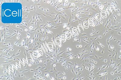 U251MG 人类星型胶质细胞瘤-原代细胞-STR细胞-细胞培养基-镜像绮点生物