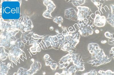 T47D 人乳腺导管癌细胞-原代细胞-STR细胞-细胞培养基-镜像绮点生物