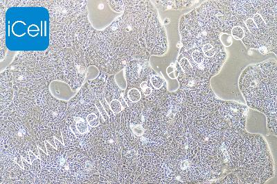 SW1116 人结肠腺癌细胞-原代细胞-STR细胞-细胞培养基-镜像绮点生物