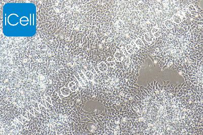 SK-N-MC 人神经上皮瘤细胞-原代细胞-STR细胞-细胞培养基-镜像绮点生物