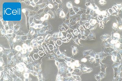 NCI-H1299 人非小细胞肺癌细胞-原代细胞-STR细胞-细胞培养基-镜像绮点生物