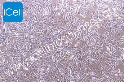 ID8 小鼠卵巢上皮癌细胞-原代细胞-STR细胞-细胞培养基-镜像绮点生物