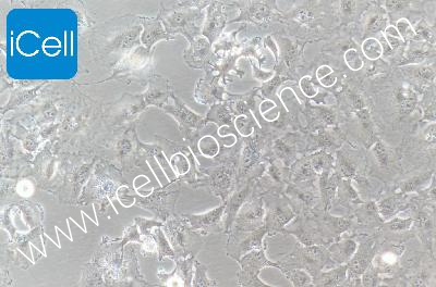 HS578T 人乳腺癌细胞-原代细胞-STR细胞-细胞培养基-镜像绮点生物