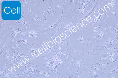 CCD841 CON 人正常结肠上皮细胞（有限细胞系）(暂不提供）-原代细胞-STR细胞-细胞培养基-镜像绮点生物