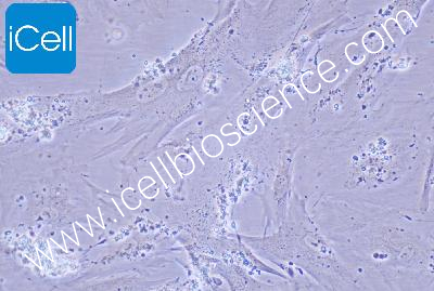 CCD841 CON 人正常结肠上皮细胞（有限细胞系）(暂不提供）-原代细胞-STR细胞-细胞培养基-镜像绮点生物