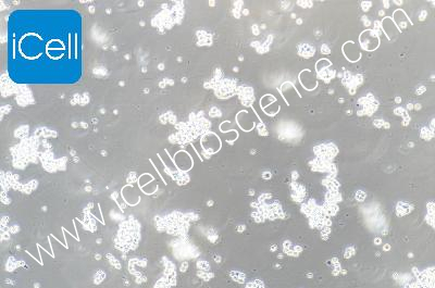 COLO320 HSR 人结直肠腺癌细胞-原代细胞-STR细胞-细胞培养基-镜像绮点生物