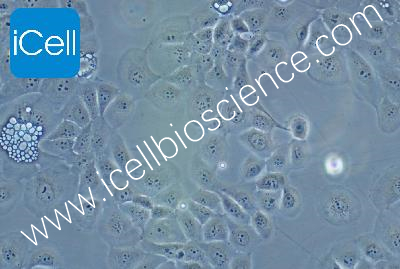 HCC1937 人乳腺癌细胞-原代细胞-STR细胞-细胞培养基-镜像绮点生物