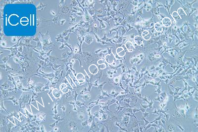 Hs746T 人胃癌细胞-原代细胞-STR细胞-细胞培养基-镜像绮点生物
