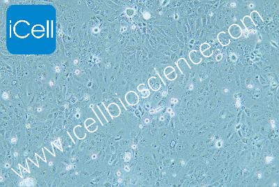 HuCCT1 人胆管癌细胞-原代细胞-STR细胞-细胞培养基-镜像绮点生物