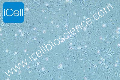 HuCCT1 人胆管癌细胞-原代细胞-STR细胞-细胞培养基-镜像绮点生物