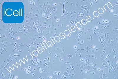 MDA-MB-157 人乳腺癌细胞-原代细胞-STR细胞-细胞培养基-镜像绮点生物