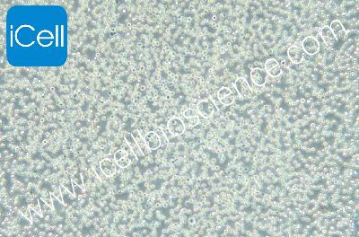 MM.1S 人多发性骨髓瘤细胞-原代细胞-STR细胞-细胞培养基-镜像绮点生物