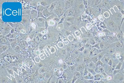 PLC-PRF-5 人肝癌亚力山大细胞-原代细胞-STR细胞-细胞培养基-镜像绮点生物