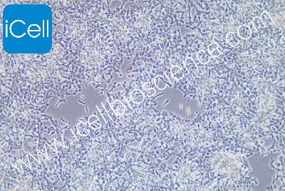 INS-1 大鼠胰岛细胞瘤细胞-原代细胞-STR细胞-细胞培养基-镜像绮点生物