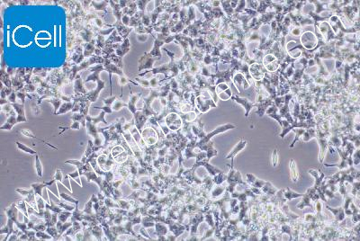 INS-1 大鼠胰岛细胞瘤细胞-原代细胞-STR细胞-细胞培养基-镜像绮点生物