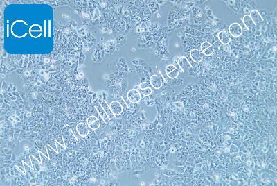 MS751 人子宫颈表皮癌细胞-原代细胞-STR细胞-细胞培养基-镜像绮点生物