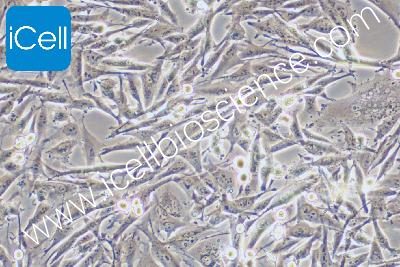 OCM1A 人眼脉络黑色素瘤细胞-原代细胞-STR细胞-细胞培养基-镜像绮点生物