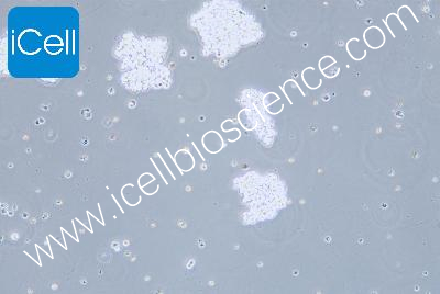 SHP-77 人小细胞肺癌细胞-原代细胞-STR细胞-细胞培养基-镜像绮点生物