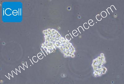 SHP-77 人小细胞肺癌细胞-原代细胞-STR细胞-细胞培养基-镜像绮点生物
