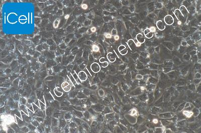 ID8+luc 小鼠卵巢上皮癌细胞+luc-原代细胞-STR细胞-细胞培养基-镜像绮点生物