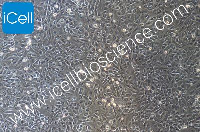 ID8+luc 小鼠卵巢上皮癌细胞+luc-原代细胞-STR细胞-细胞培养基-镜像绮点生物