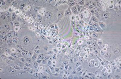 NCM460 人正常结肠上皮细胞-原代细胞-STR细胞-细胞培养基-镜像绮点生物