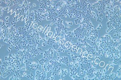 DMS 53 人肺癌细胞-原代细胞-STR细胞-细胞培养基-镜像绮点生物