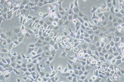 NPC/HK-1 人鼻咽癌细胞-原代细胞-STR细胞-细胞培养基-镜像绮点生物