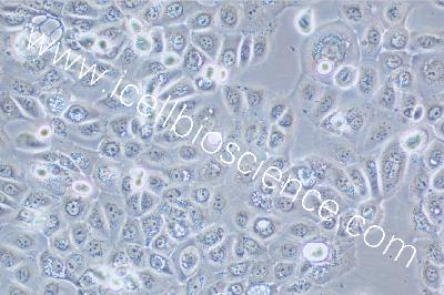 SCC-25 人口腔鳞癌细胞-原代细胞-STR细胞-细胞培养基-镜像绮点生物