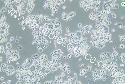 ZR-75-30 人乳腺癌细胞-原代细胞-STR细胞-细胞培养基-镜像绮点生物