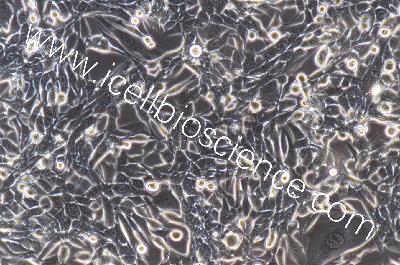 PANC02+luc 小鼠胰腺癌细胞（荧光素酶标记）-原代细胞-STR细胞-细胞培养基-镜像绮点生物